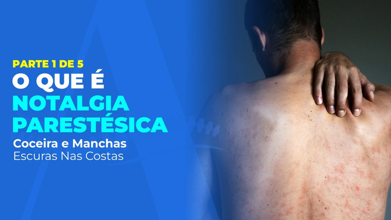 O que é NOTALGIA PARESTÉSICA - Parte 1 de 5: Coceira e Manchas Escuras